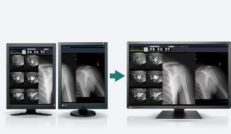 Medical Monitors & PACS Display Monitors | EIZO