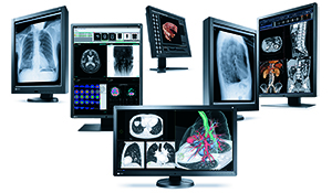 RadiNET Pro Hosting for Medical Enterprises - RadiForce | EIZO
